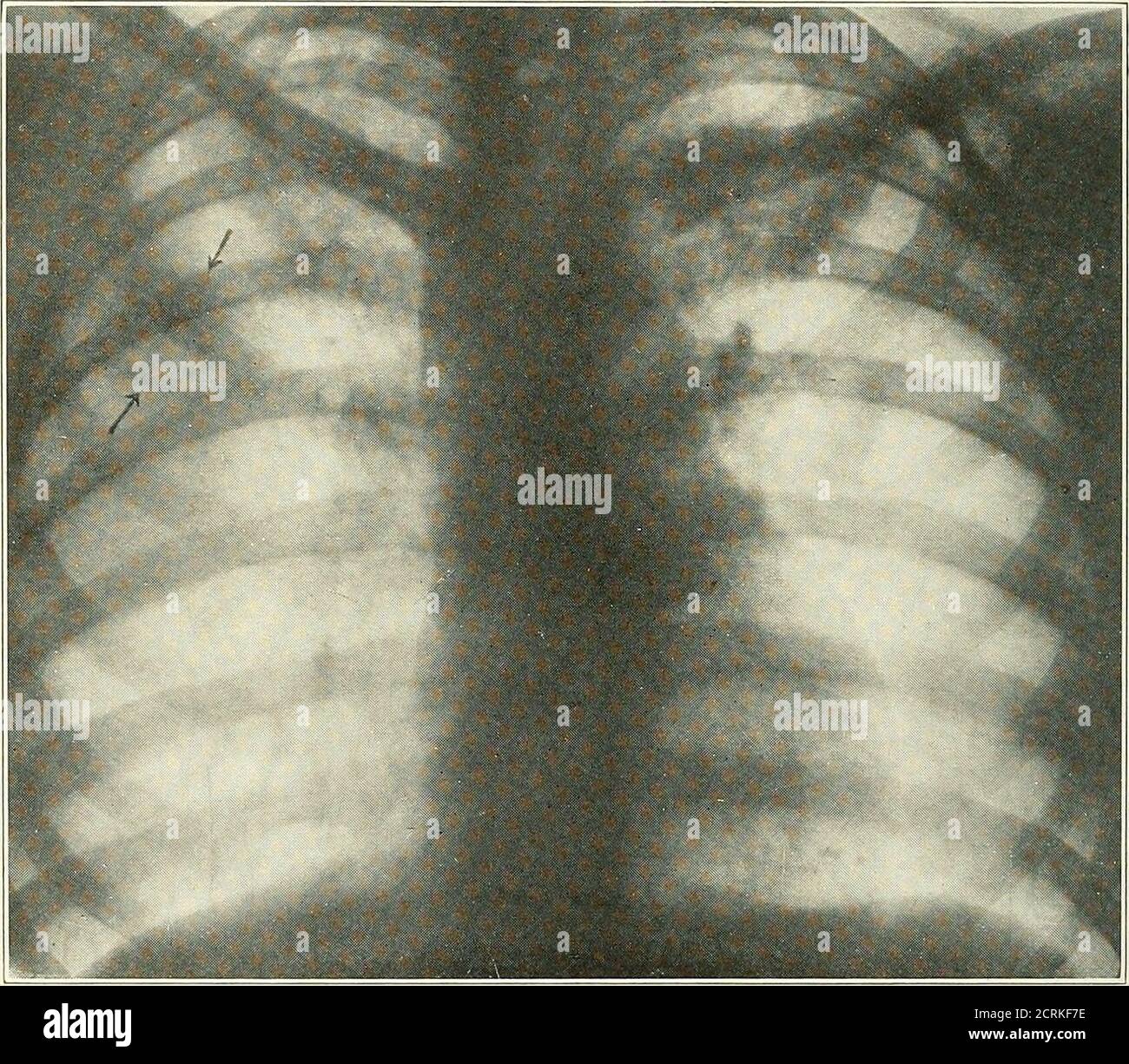 . Roentgen interpretation; a manual for students and practitioners . he ...