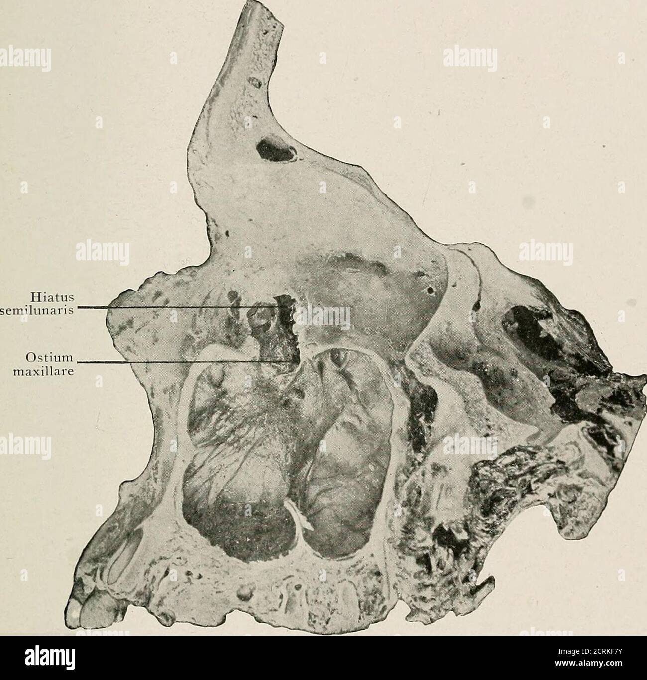 . Interpretation of dental and maxillary roentgenograms . ^ extend as ...