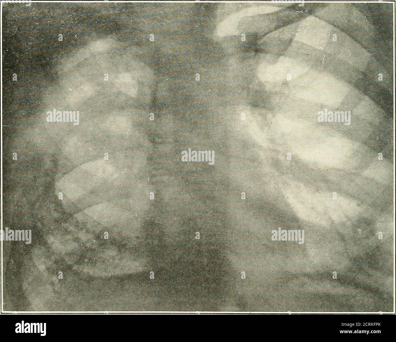 . Roentgen interpretation; a manual for students and practitioners ...