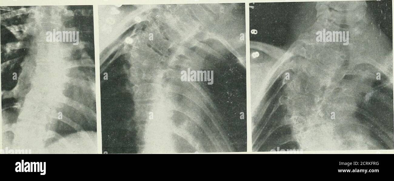 Physical anomalies hi-res stock photography and images - Alamy