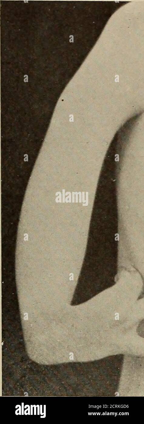 . Living anatomy and pathology; . PLATE 51.CONGENITAL DEFORMITY OF ...