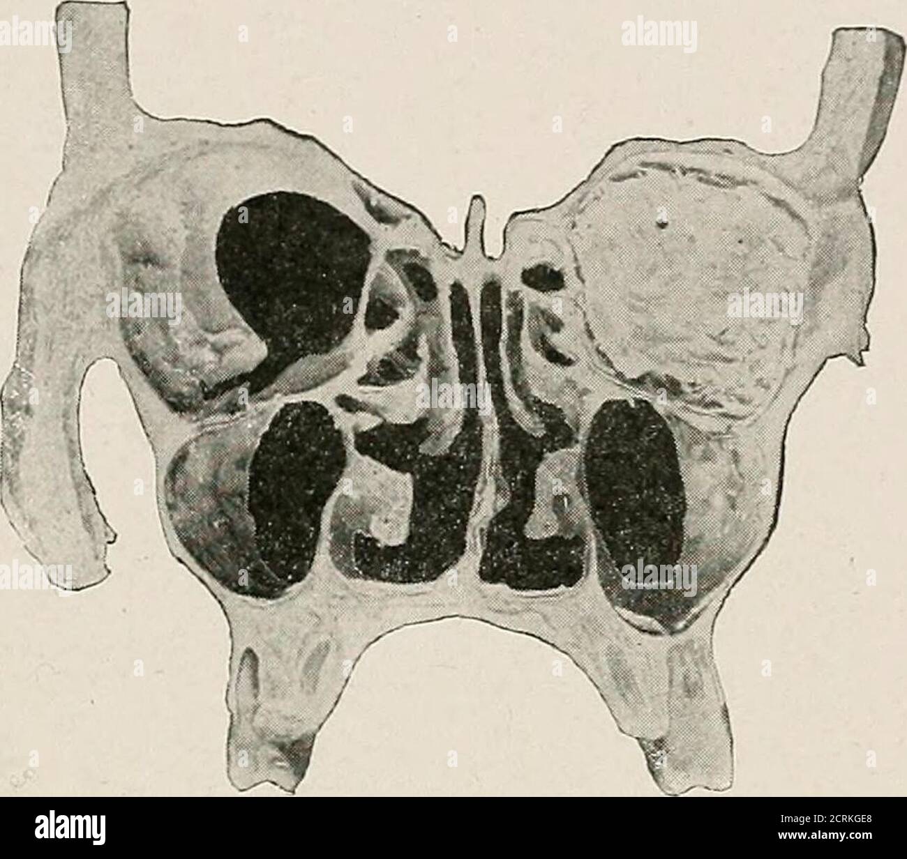 . Interpretation of dental and maxillary roentgenograms . Fig. 2 ...