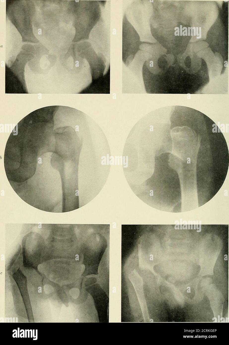 Normal child x ray hi-res stock photography and images - Alamy