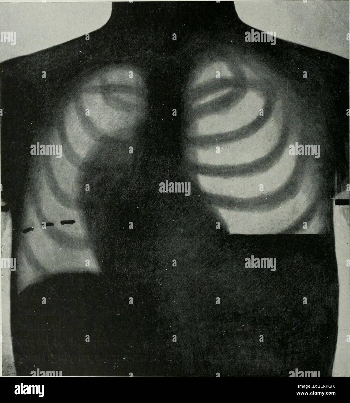 . The Roentgen rays in medicine and surgery as an aid in diagnosis and ...