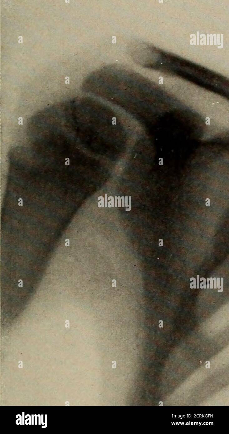 . Living anatomy and pathology; . PLATE 48.CONGENITAL ELEVATION OF ...