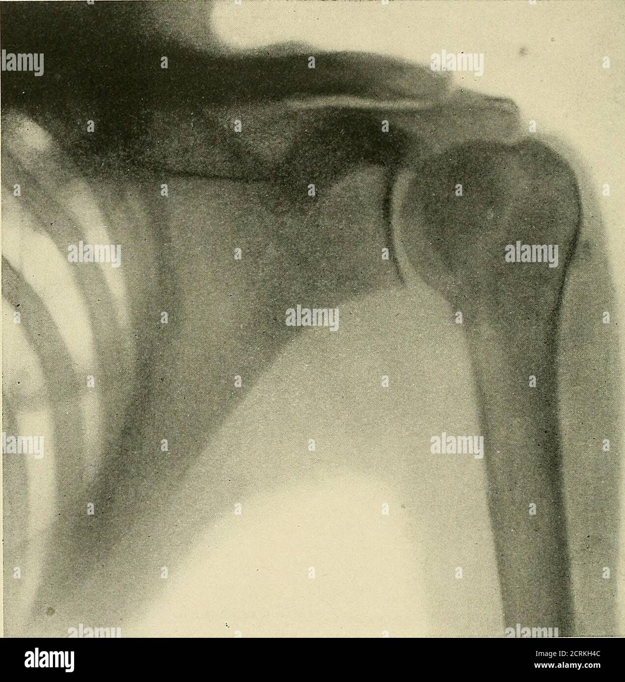 . Röntgen ray diagnosis and therapy . Fig. 126.—Anterior View of ...
