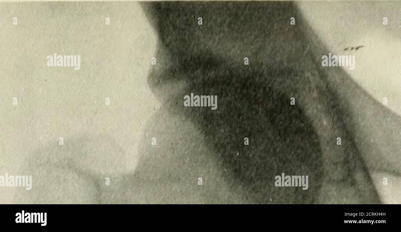 . Radiography, x-ray therapeutics and radium therapy . Fig. 141 ...
