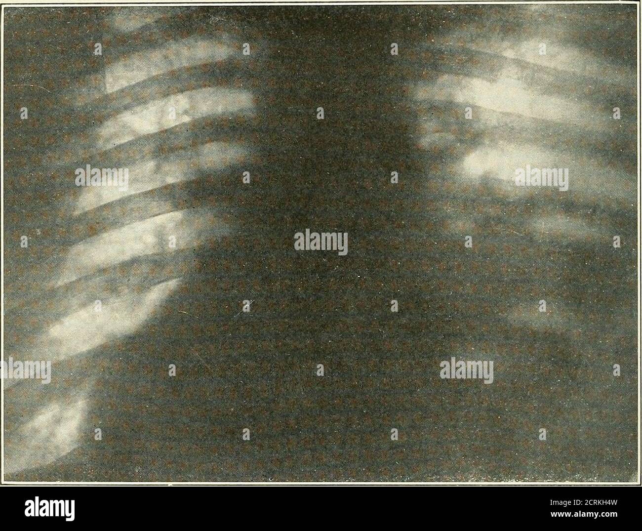 . Roentgen interpretation; a manual for students and practitioners . be ...