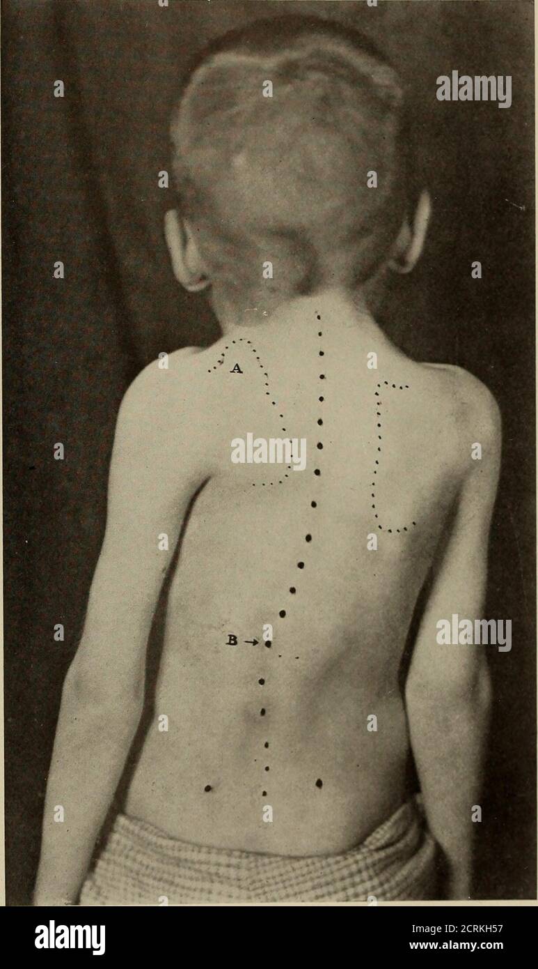 . Living anatomy and pathology; . PLATE 47.CONGENITAL ELEVATION OF ...