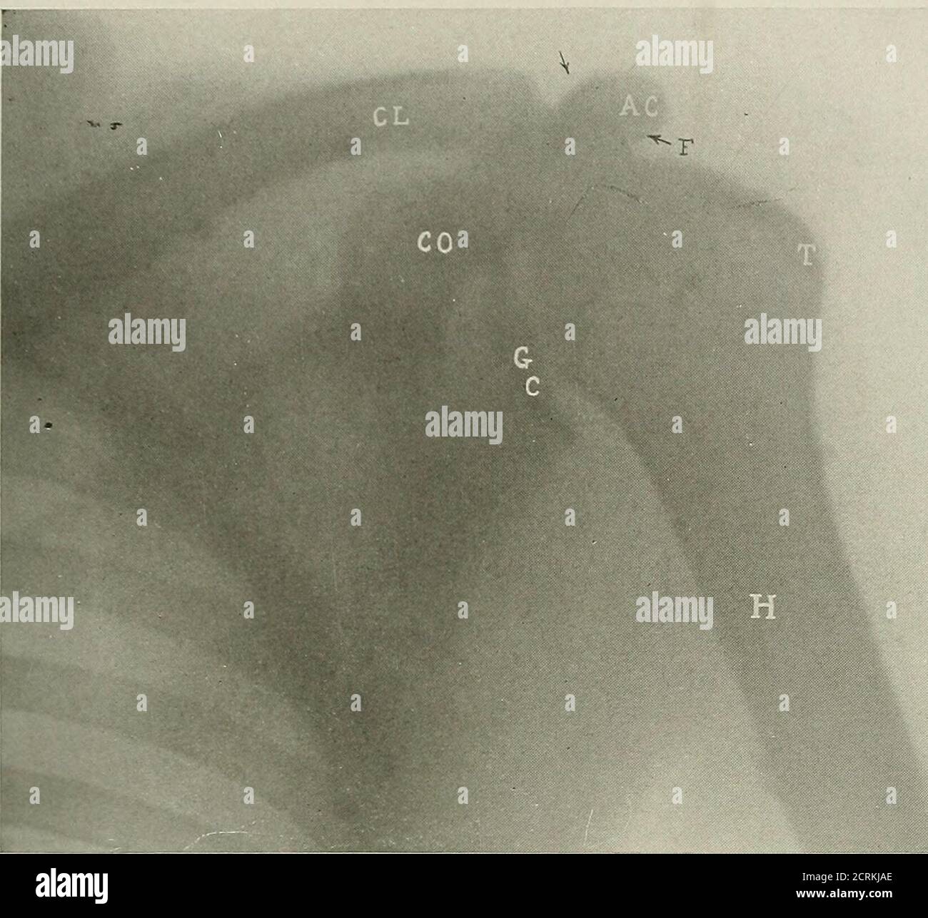 . Röntgen rays and electro-therapeutics : with chapters on radium and ...