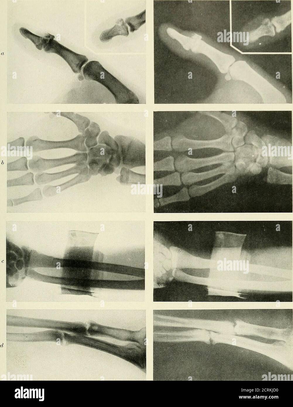 . Radiography, x-ray therapeutics and radium therapy . Autero-posterior ...