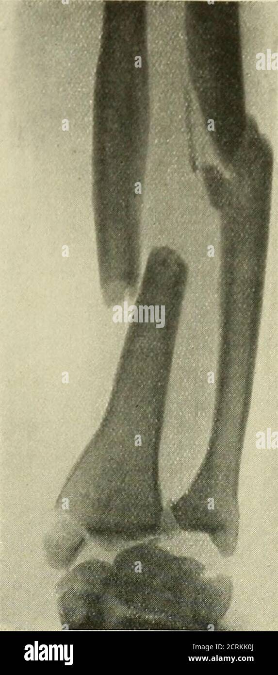 . Radiography, x-ray therapeutics and radium therapy . Fig. 138 ...