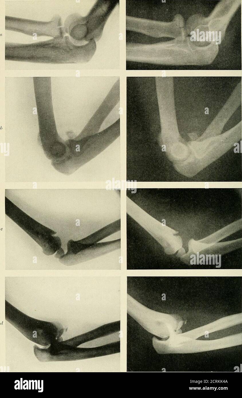 Lowerpoint hi-res stock photography and images - Alamy