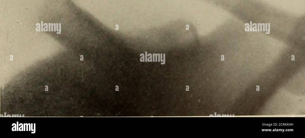 . Living anatomy and pathology Stock Photo - Alamy