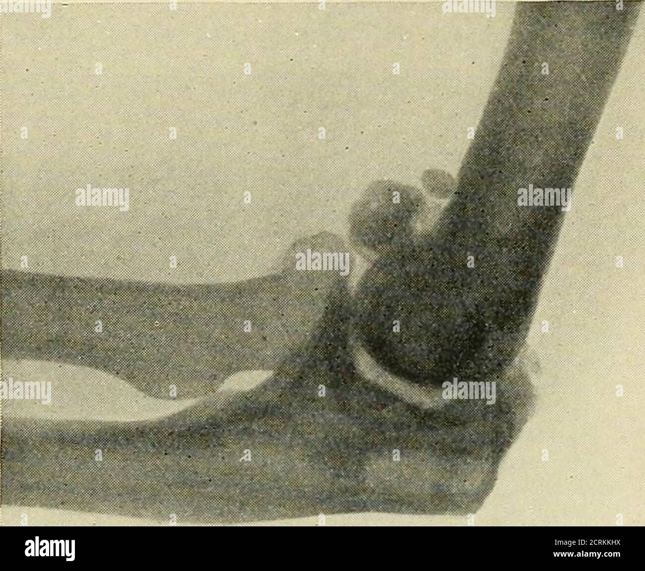 . Radiography, x-ray therapeutics and radium therapy . Fig. 135 ...