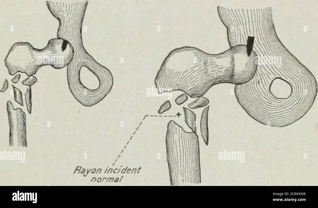 Radium 228 hi-res stock photography and images - Alamy
