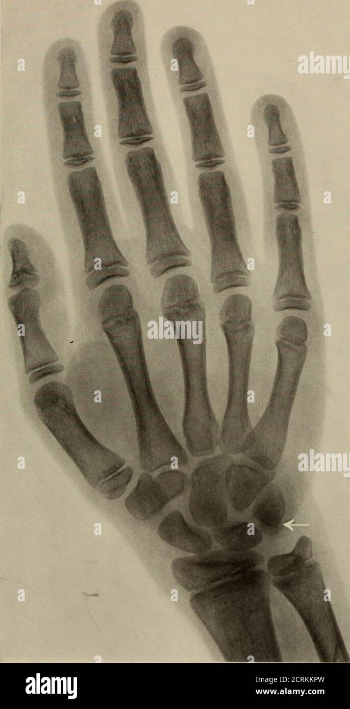 . Living anatomy and pathology; . PLATE 39.GROUP L. NORMAL. Girl, age ...