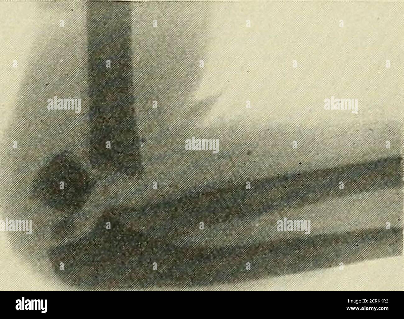 . Radiography, x-ray therapeutics and radium therapy . Fig. 134 ...