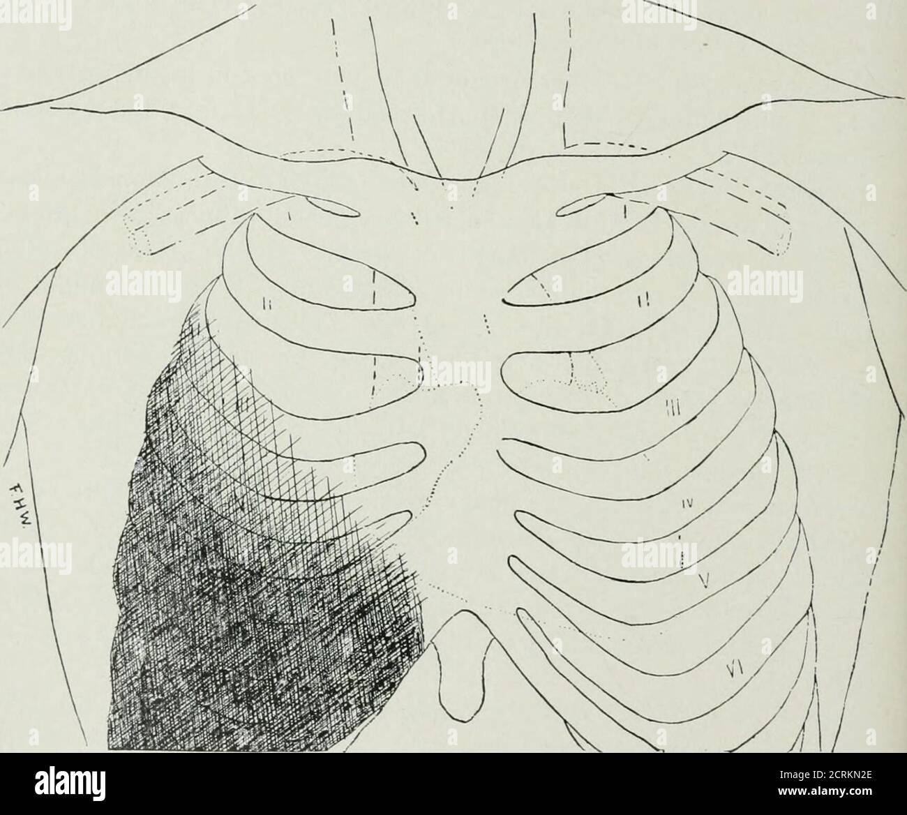 Sixth rib hi-res stock photography and images - Alamy