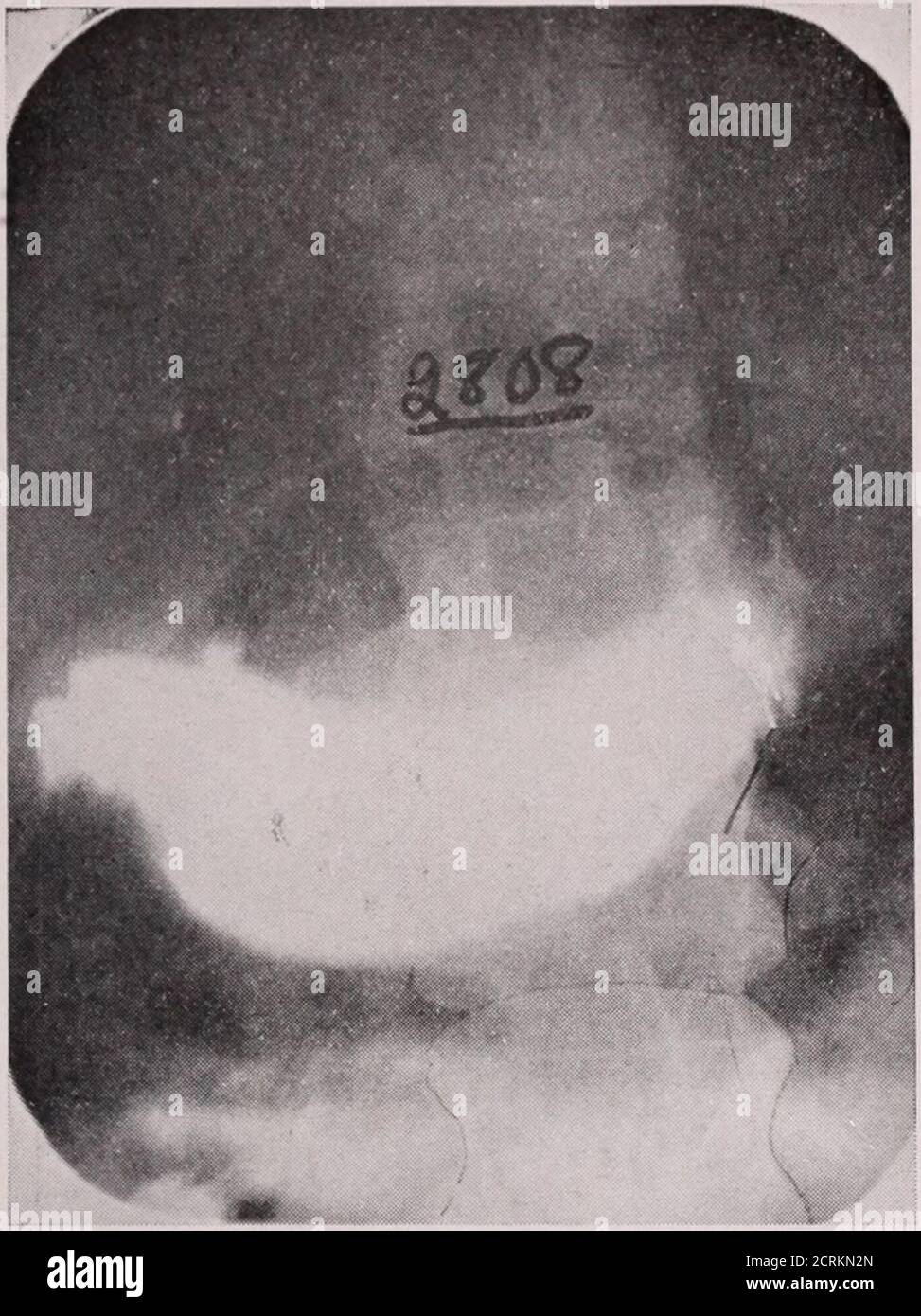 . Journal of radiology . Case No. 2899gallbladder. Page Ten GALLBLADDER ...