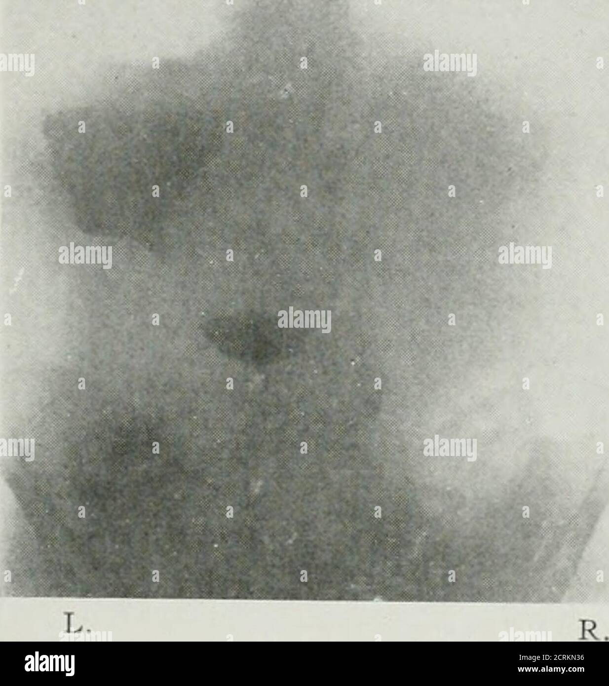 Hypotonic patient hi-res stock photography and images - Alamy