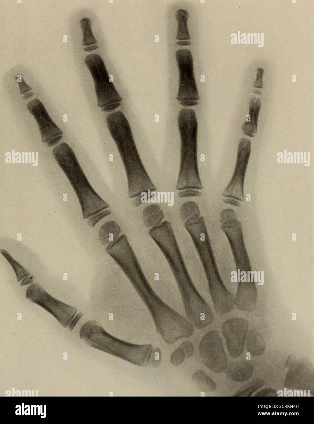 Group trapezoid hi-res stock photography and images - Alamy