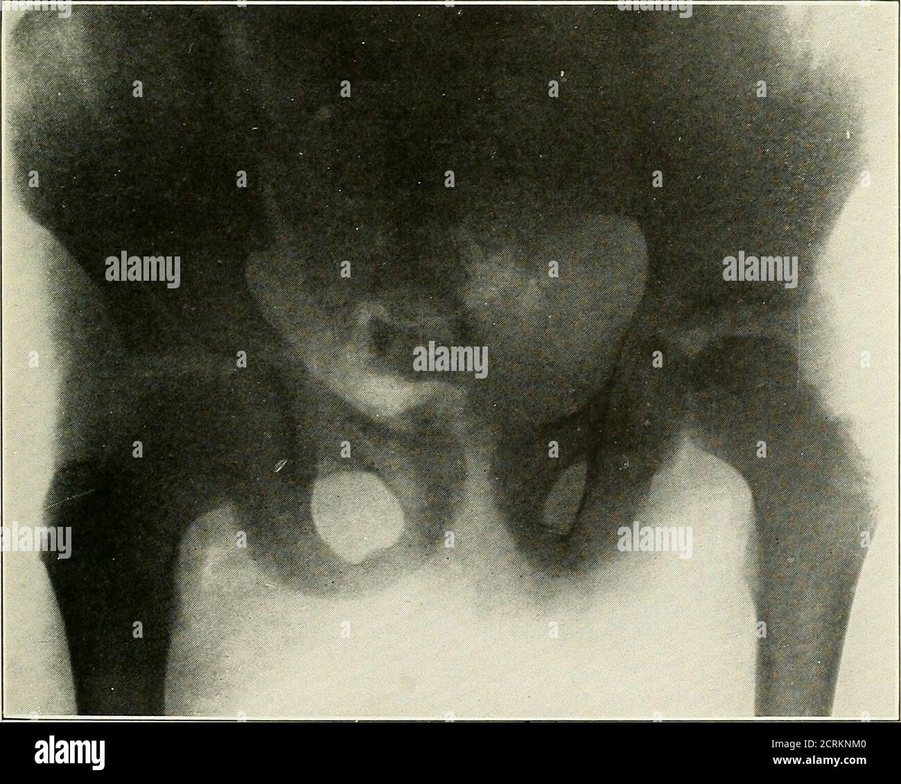 . Roentgen interpretation; a manual for students and practitioners ...