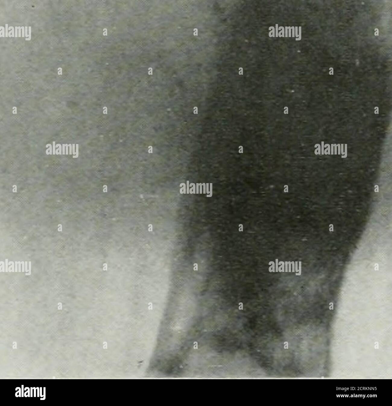 . The American journal of roentgenology, radium therapy and nuclear ...