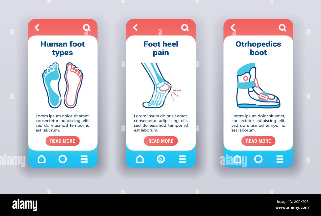 Foot disease and treatment on mobile app onboarding screens Stock ...