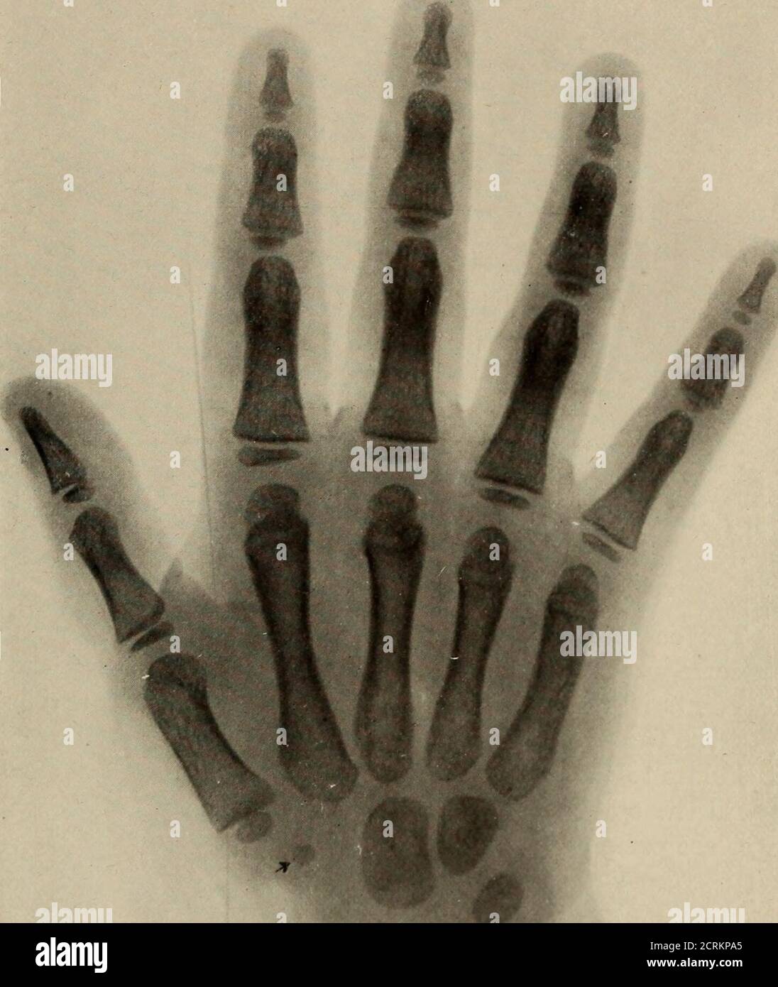 . Living anatomy and pathology; . PLATE 32.GROUP E. NORMAL. Girl, age ...