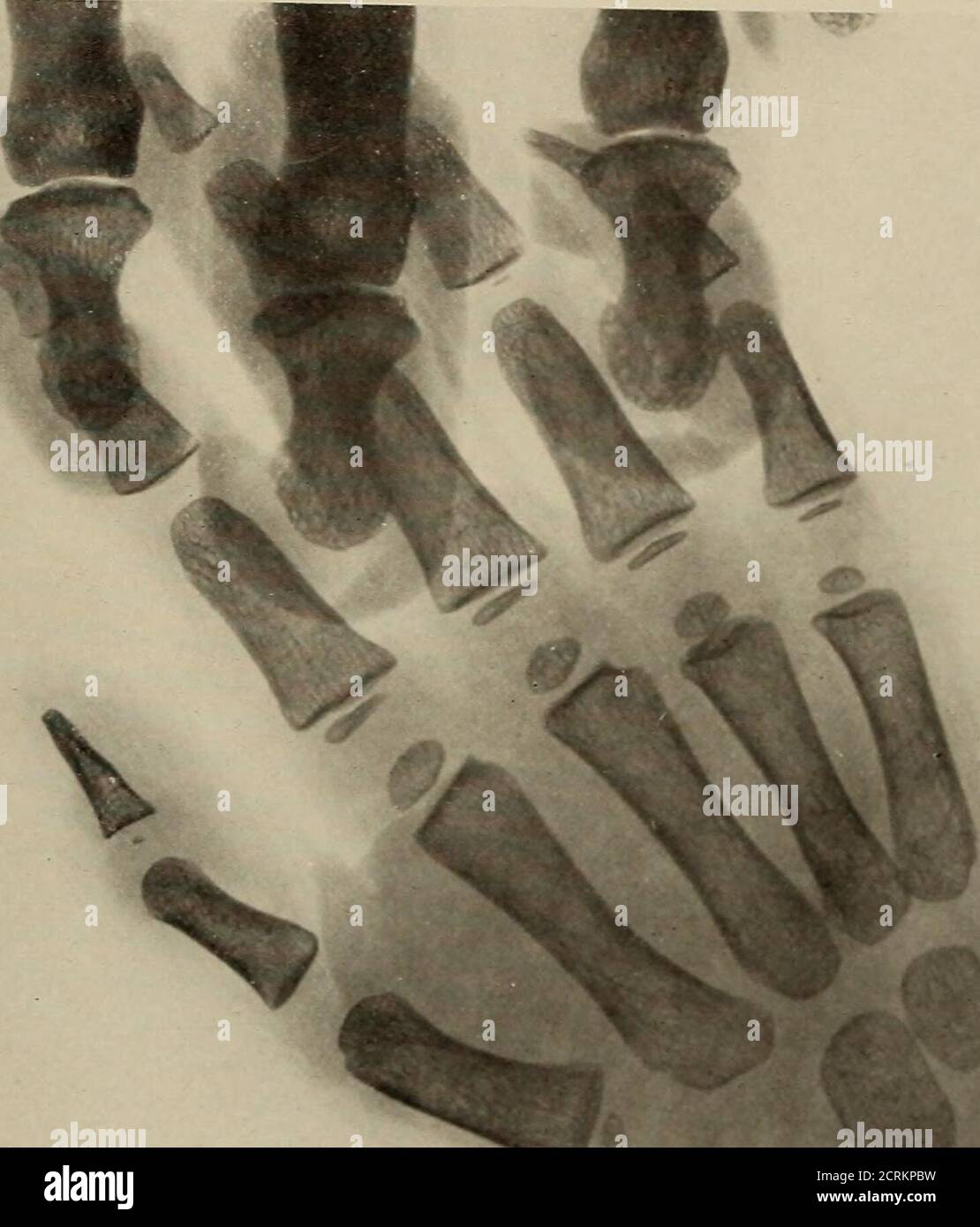. Living anatomy and pathology; . PLATE 29.GROUP B. NORMAL. Girl, age 2 ...