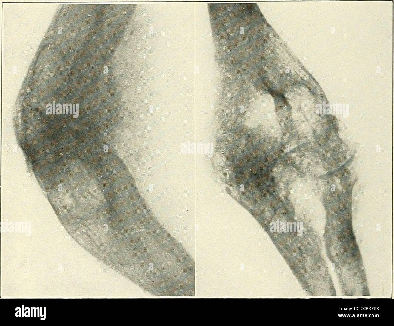 . Roentgen interpretation; a manual for students and practitioners ...