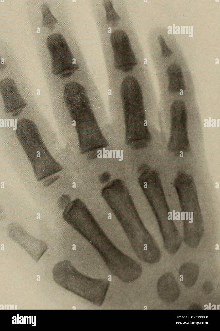 . Living anatomy and pathology; . PLATE 30.GROUP C. NORMAL. Girl, age 2 ...