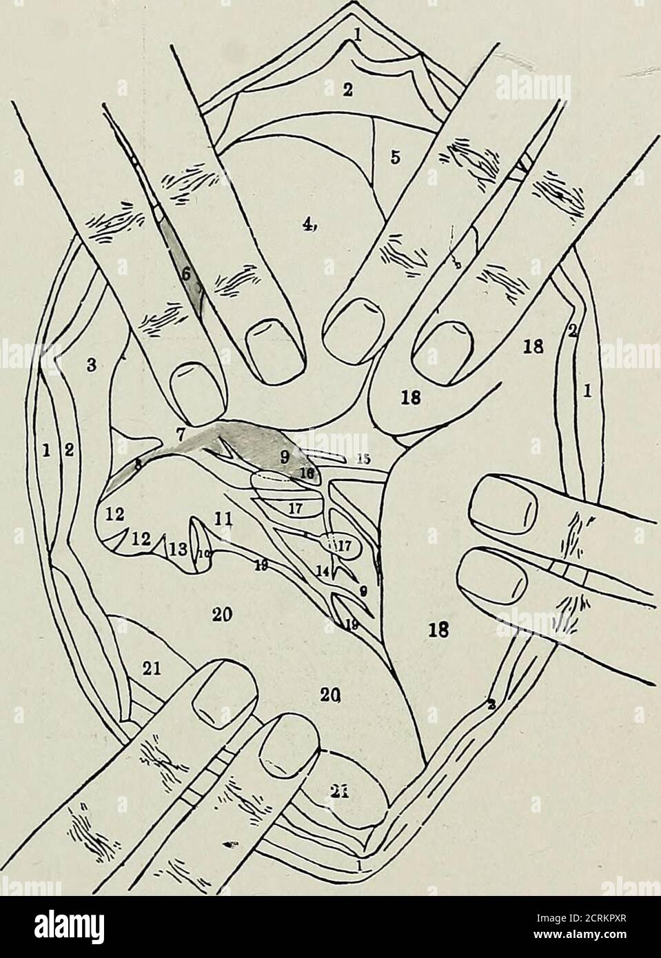 . Diseases of the gall-bladder and bile-ducts, including gall-stones ...