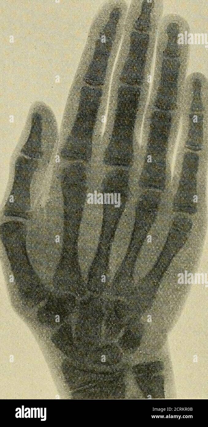 . Radiography, x-ray therapeutics and radium therapy . Fig. 120 ...
