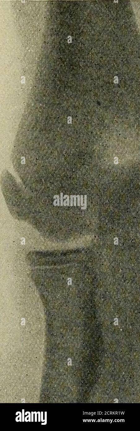 . Radiography, x-ray therapeutics and radium therapy . FlG. 123 ...