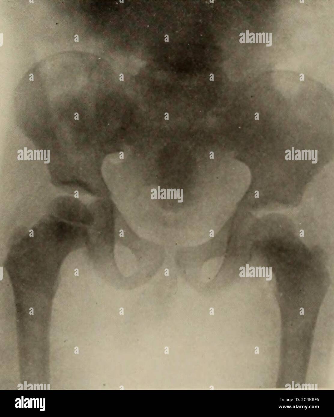 . Living anatomy and pathology; . Stock Photo - Alamy