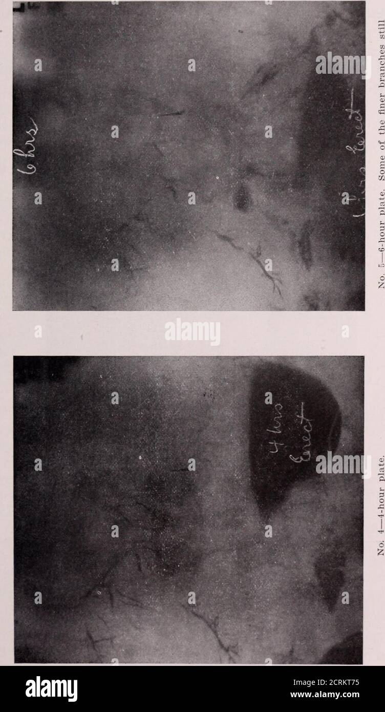 Slug anatomy hi-res stock photography and images - Alamy