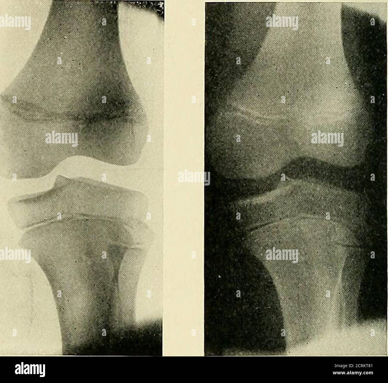 . Radiography, x-ray therapeutics and radium therapy Stock Photo - Alamy