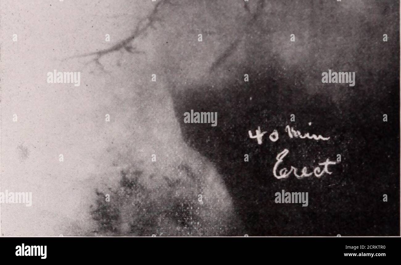 Slug anatomy hi-res stock photography and images - Alamy