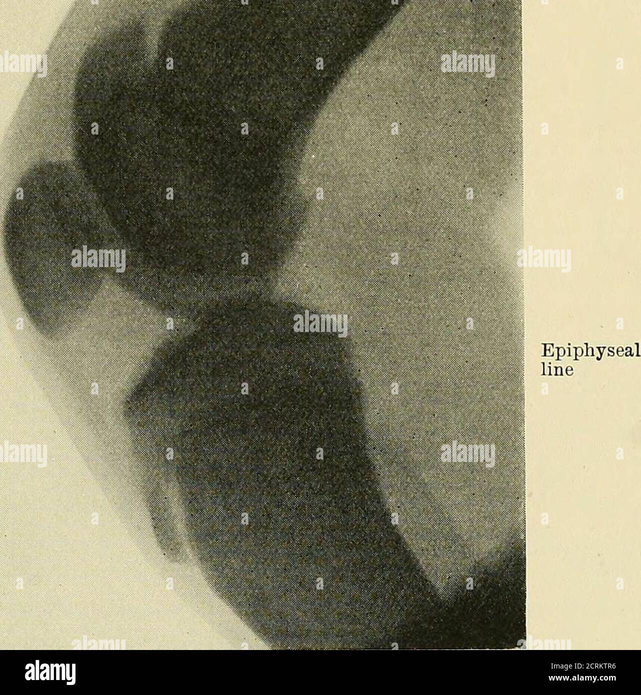 . Radiography, x-ray therapeutics and radium therapy . Antero-posterior ...