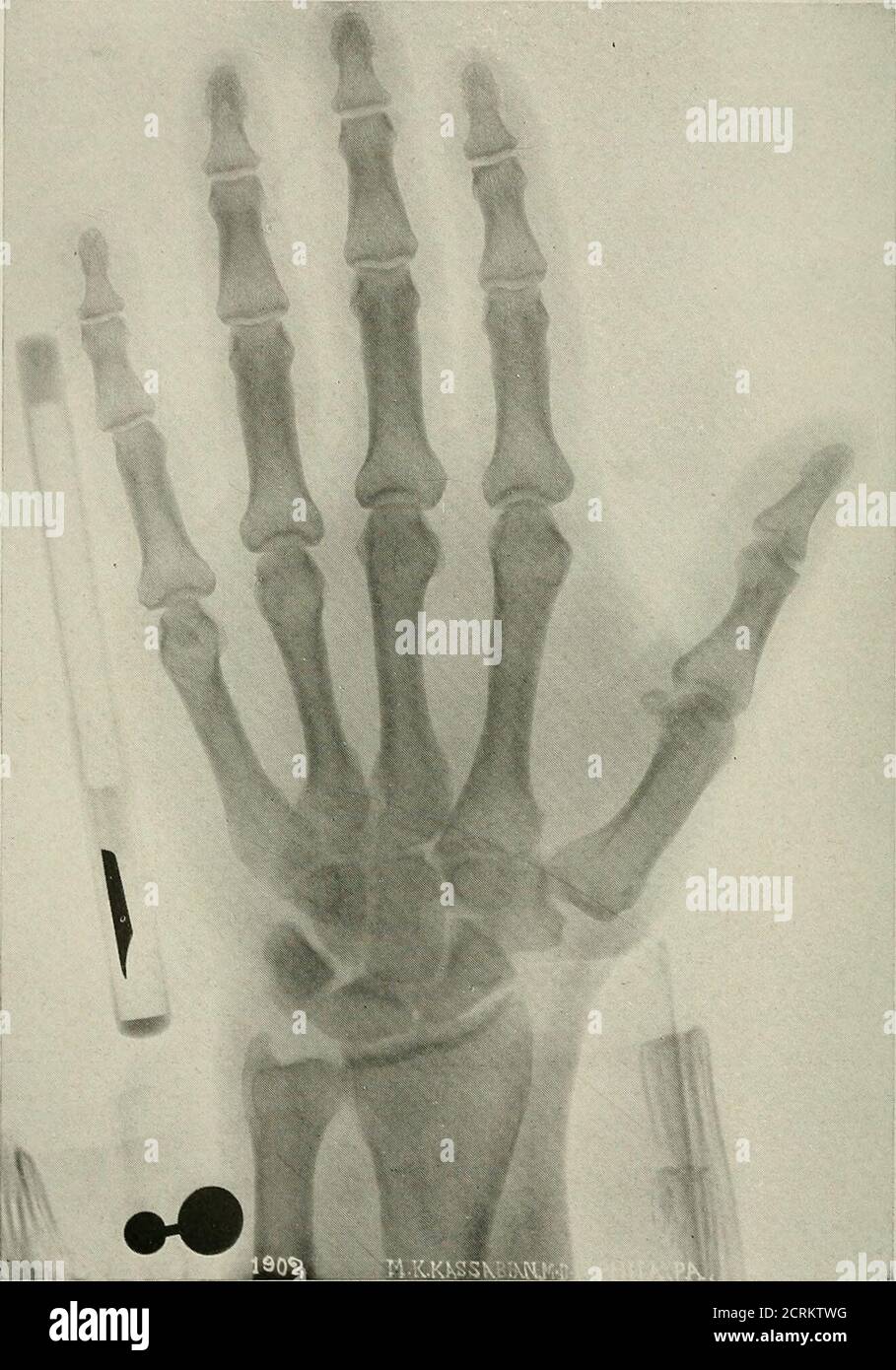 . Röntgen rays and electro-therapeutics : with chapters on radium and ...