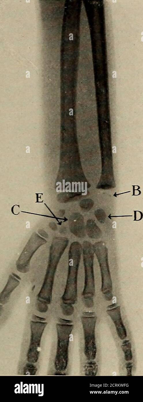 . Living anatomy and pathology; . PLATE 15. Age 6 years. (Reduced 63% ...