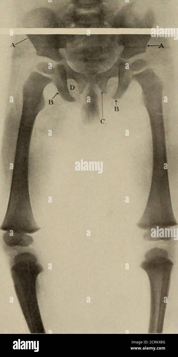 . Living anatomy and pathology; . PLATE 13.NORMAL KNEES, LOWER LEGS ...