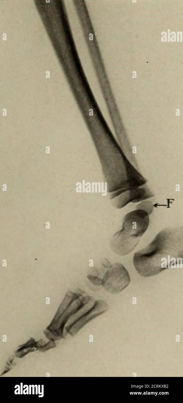 . Living anatomy and pathology Stock Photo - Alamy