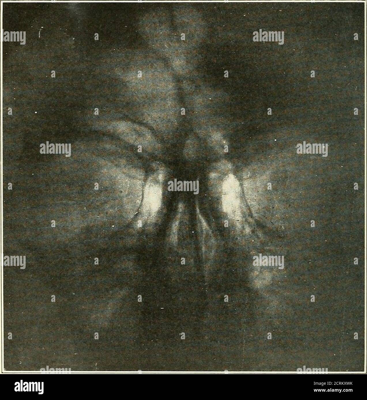 . Roentgen interpretation; a manual for students and practitioners ...
