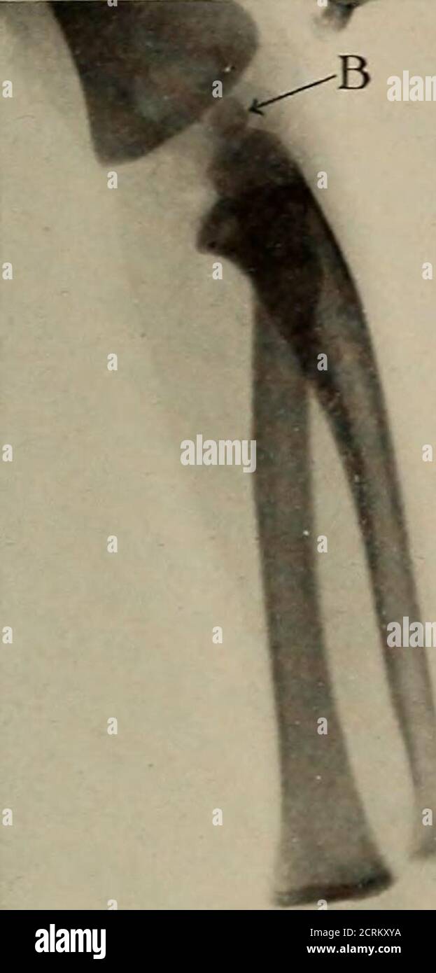 . Living anatomy and pathology; . ^ ^H PLATE 11. Age 2 years. (Reduced ...