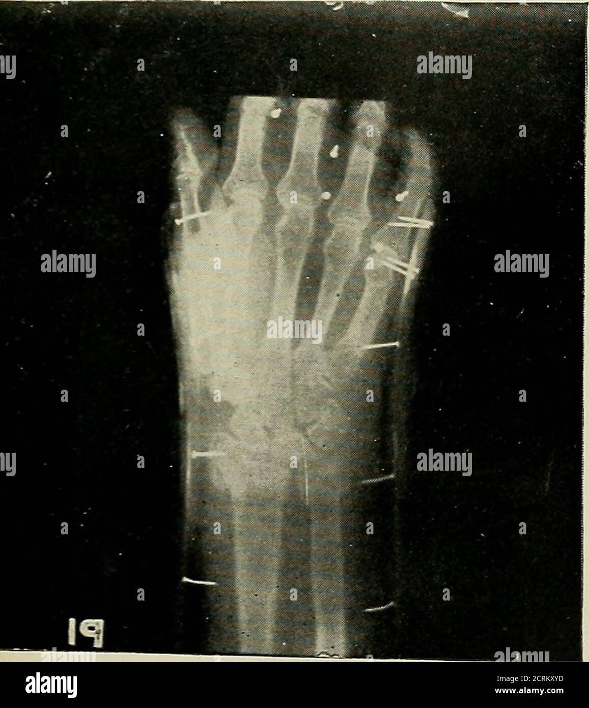 . Röntgen rays and electro-therapeutics : with chapters on radium and ...