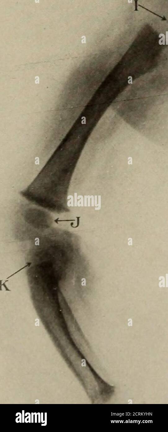 . Living anatomy and pathology Stock Photo - Alamy