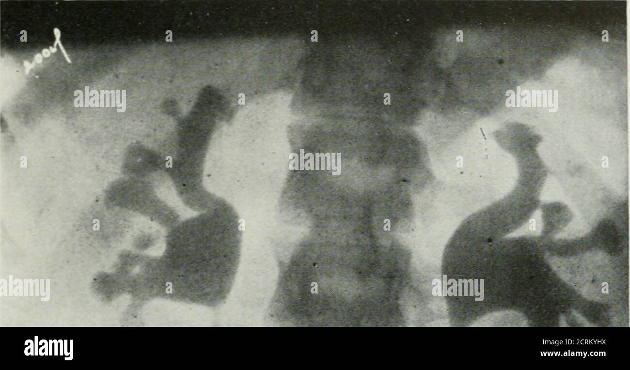 Nuclear medicine injection hi-res stock photography and images - Alamy